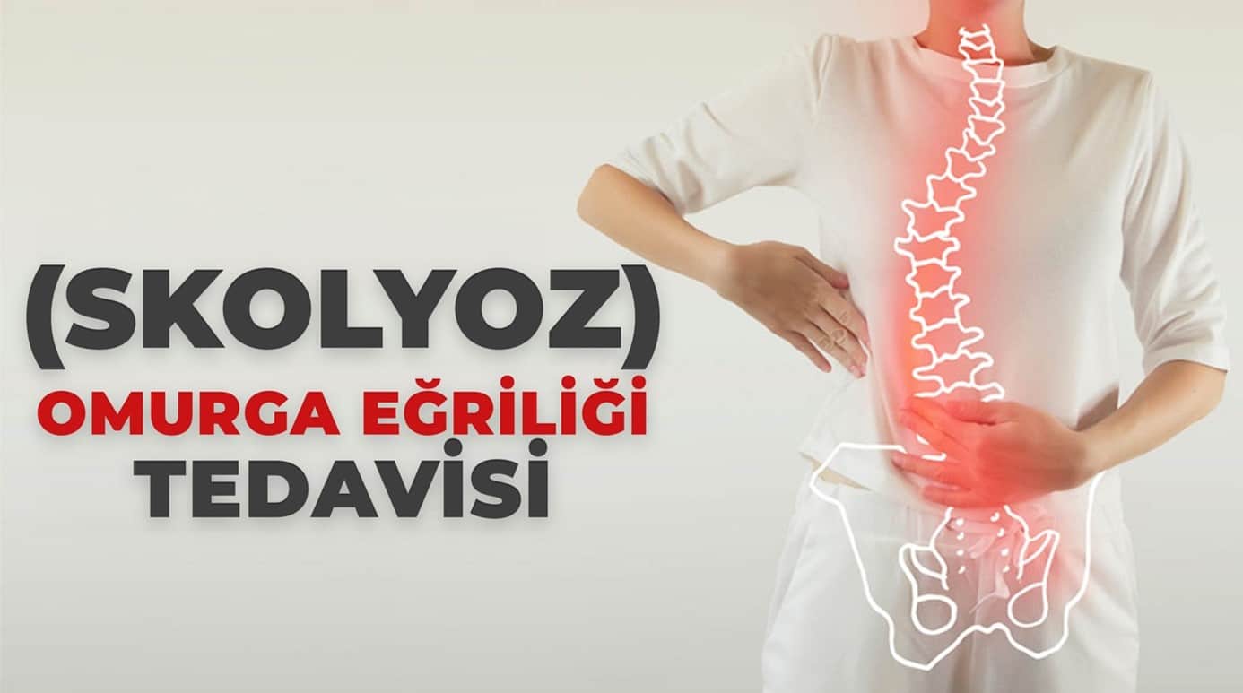 Skolyoz Cerrahi - Op. Dr. Fatih Kırar